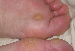 Discover Siddha Treatments in Chennai Hospital
